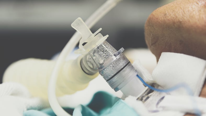 Tracheostomy Advantages and Disadvantages